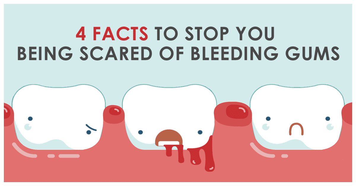 4 Facts to stop you Being Scared of Bleeding Gums - Dental Suite